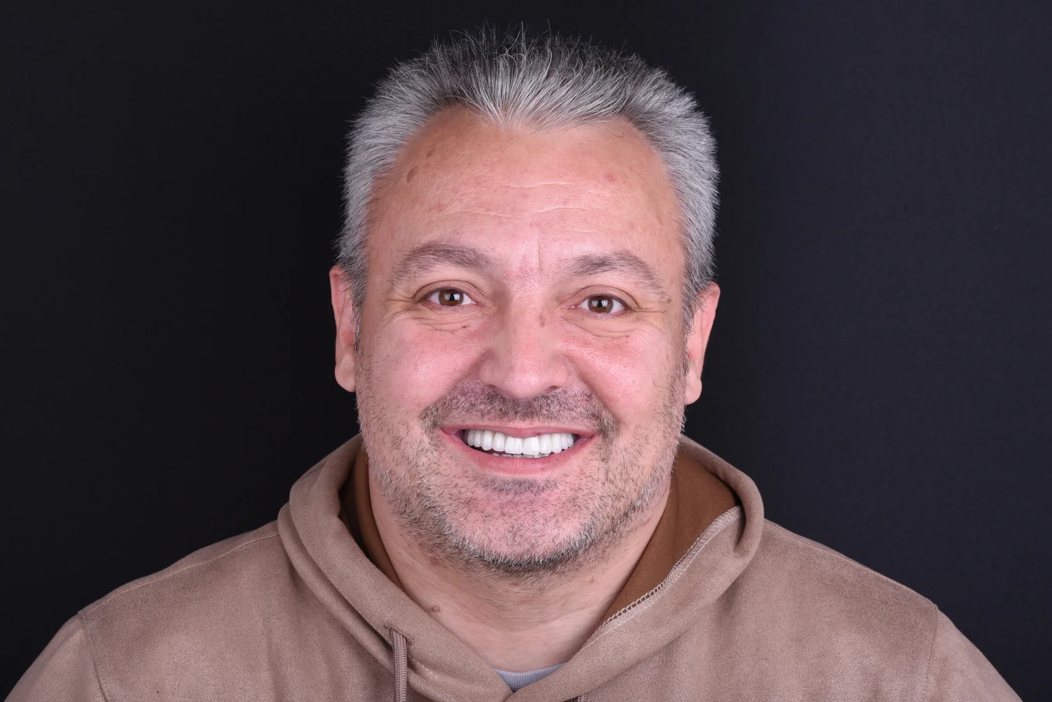 Blog: Zygomatic Implants | Milim Dental Hospital